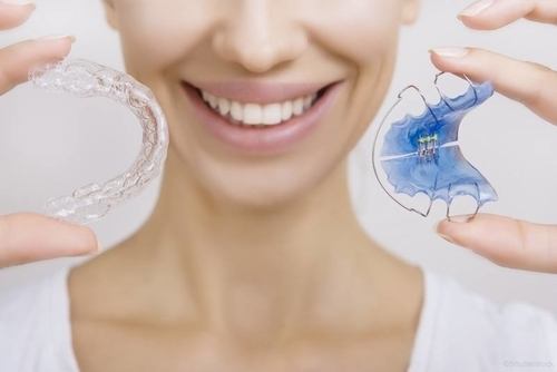Is Your Retainer Feeling Tight? Don’t Panic! Here’s What You Need to ...